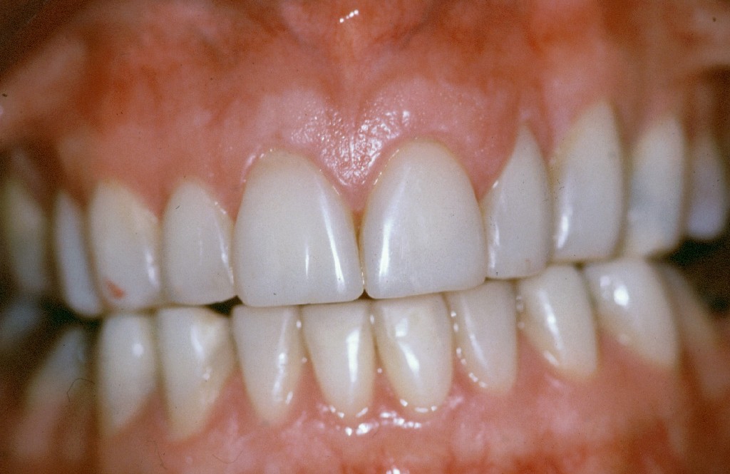 Cosmetic Dentistry – Dentalk